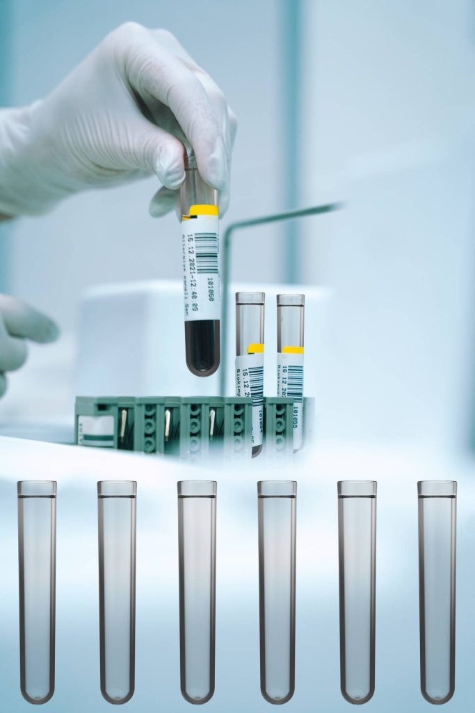 Time- And Cost-Saving Core-Centering Feature Is Ideal For Blood ...